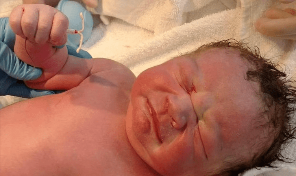US Baby Born Holding Mum’s Contraceptive Coil Goes Viral