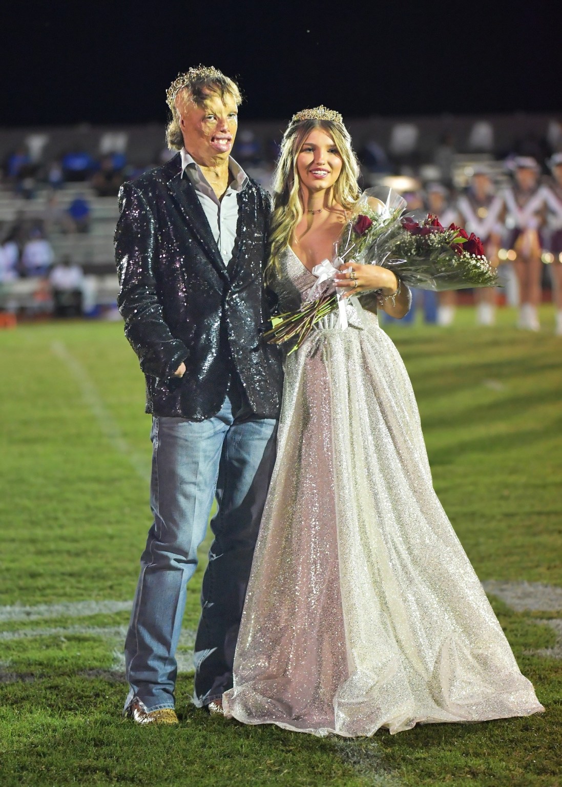 Texas Teen Who Survived Devastating Fire Crowned Homecoming King